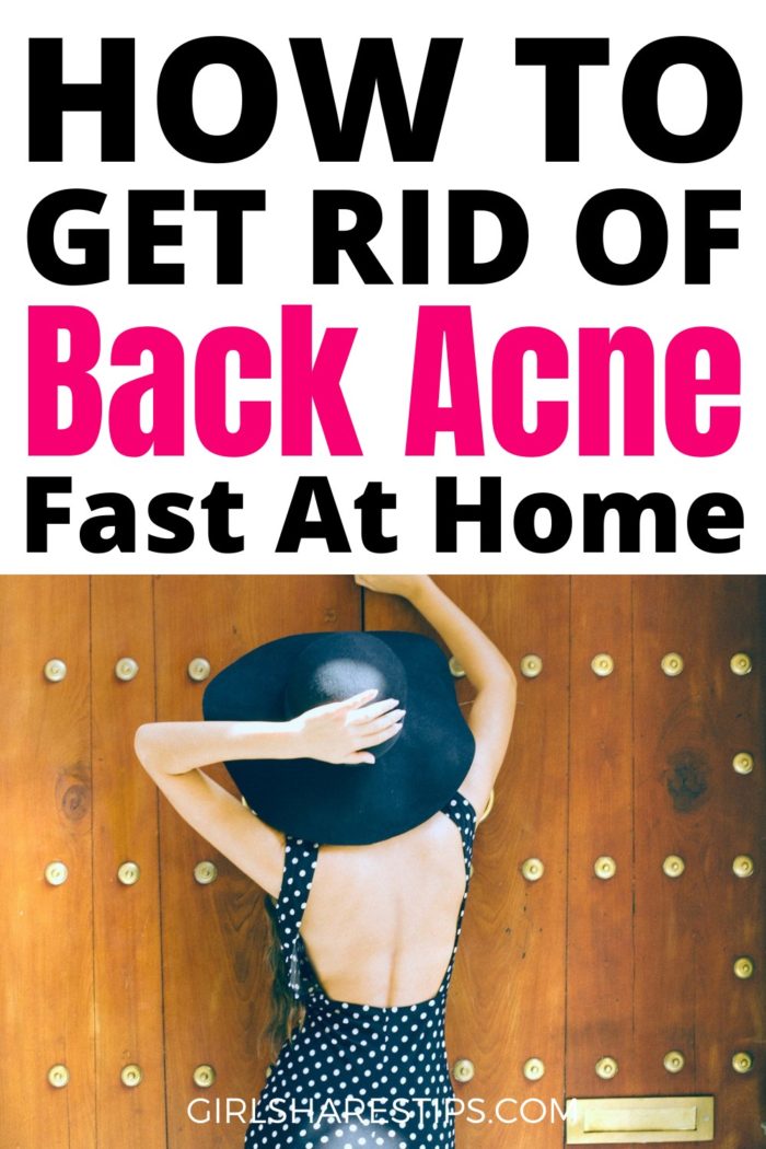 How To Get Rid Of Back Acne Fast: Proven Tips And Products - Girl ...